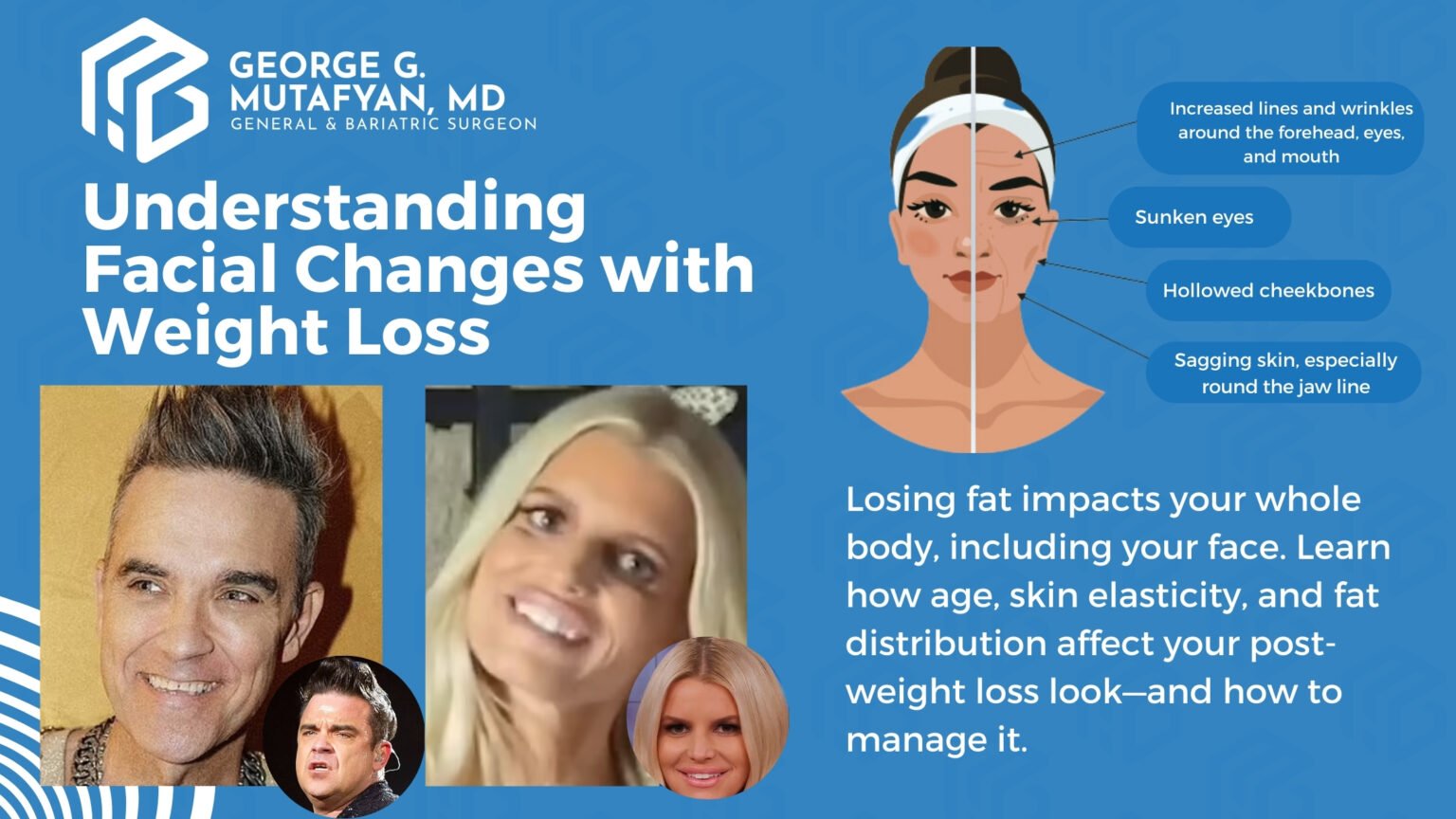 The Ozempic Face Scare: Why Some People Look Sick After Weight Loss ...